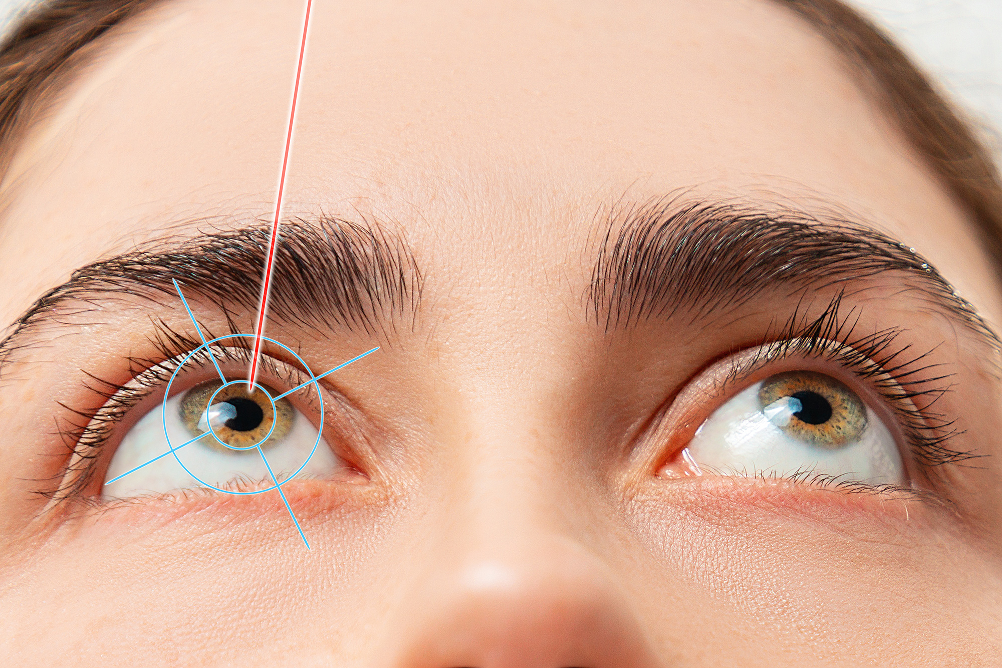 How Old Do You Have To Be For LASIK | Vision Clinic Sydney
