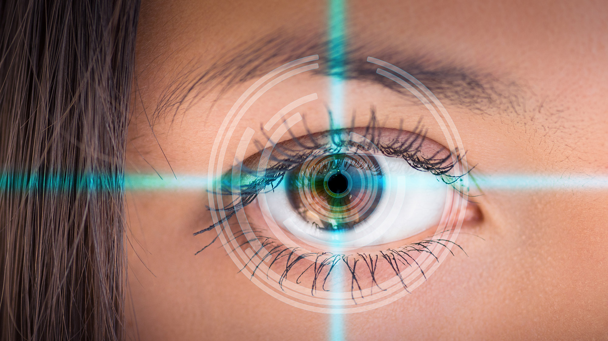 Types of Laser Eye Surgery | Vision Clinic Sydney